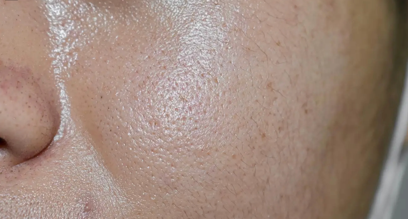 Diagnose My Skin – HIGHLANDSCOSMETICSS